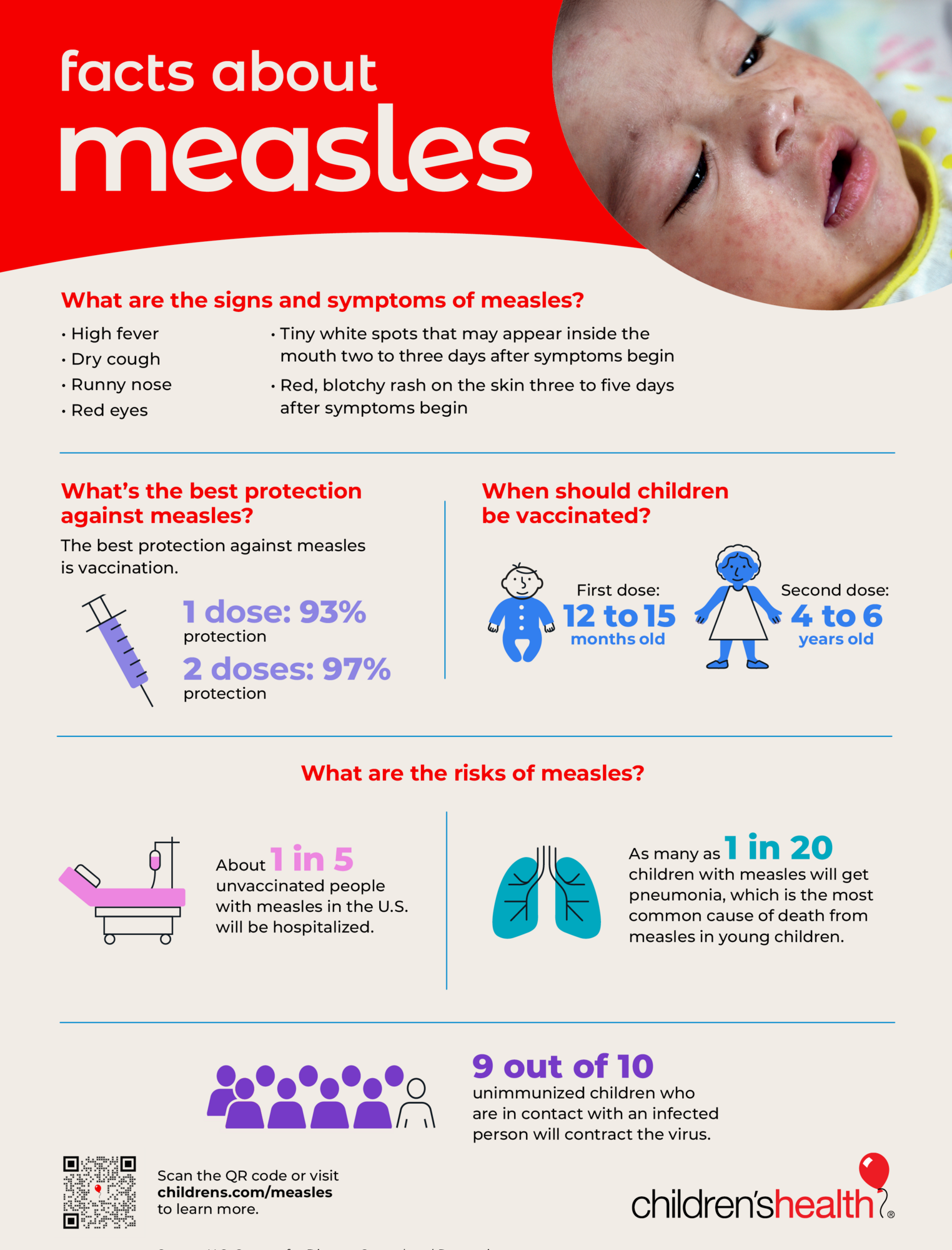 Measles In Babies